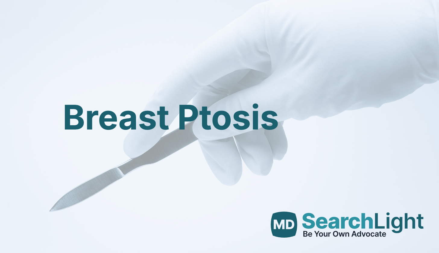 Breast Ptosis (Mastopexy) - MD Searchlight