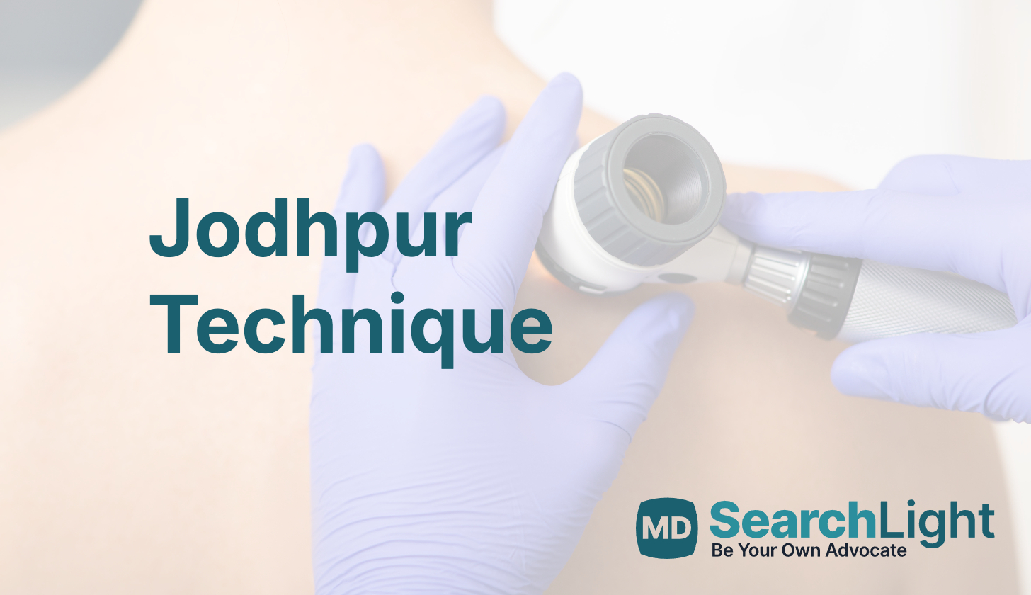 Jodhpur Technique - MD Searchlight